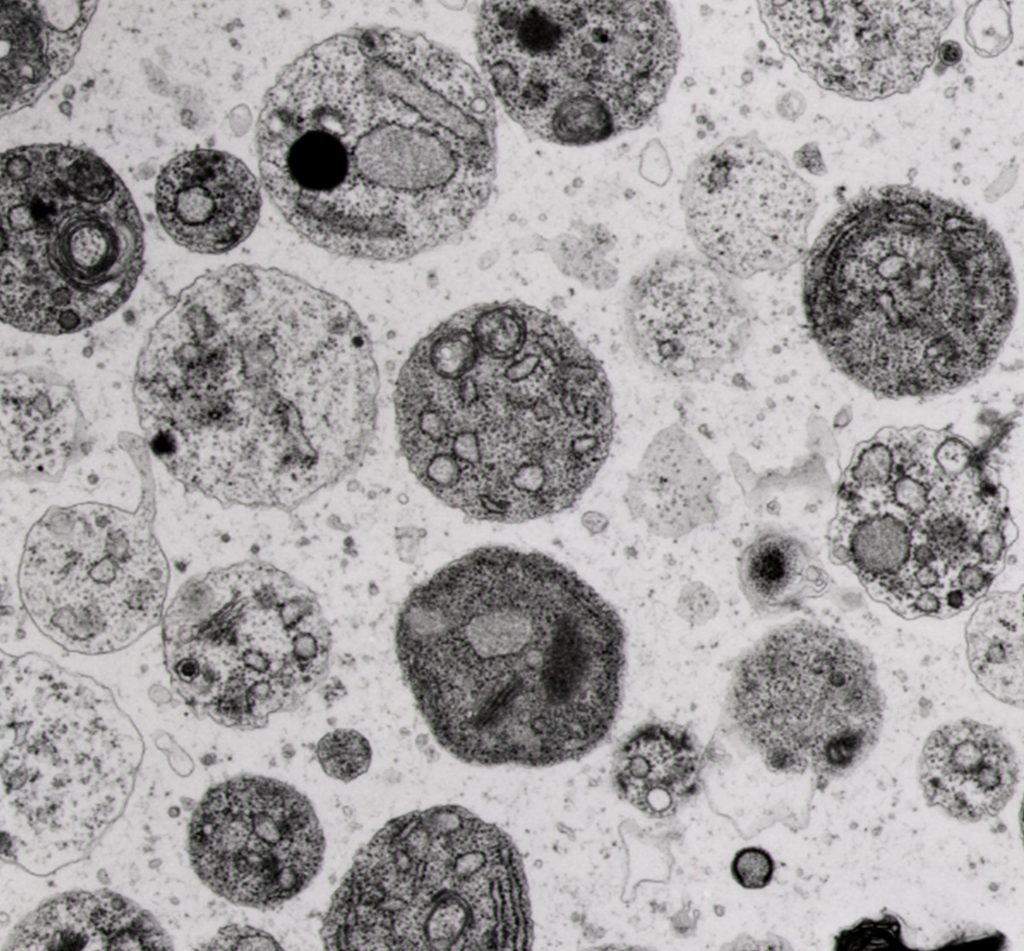 Molecular Mechanisms of Autophagy, an Intracellular Self-Degradation ...